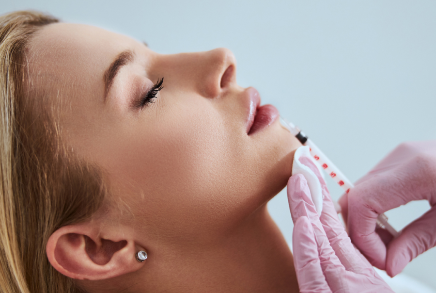 Why Lip Filler Looks Great