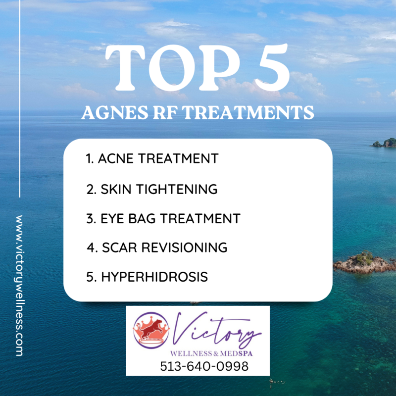 Top 5 Agnes RF Treatments – Victory Wellness Cincinnati – Botox ...